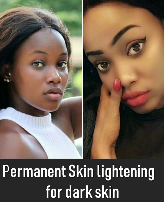 Skin Lightening in Secunda+27731769304